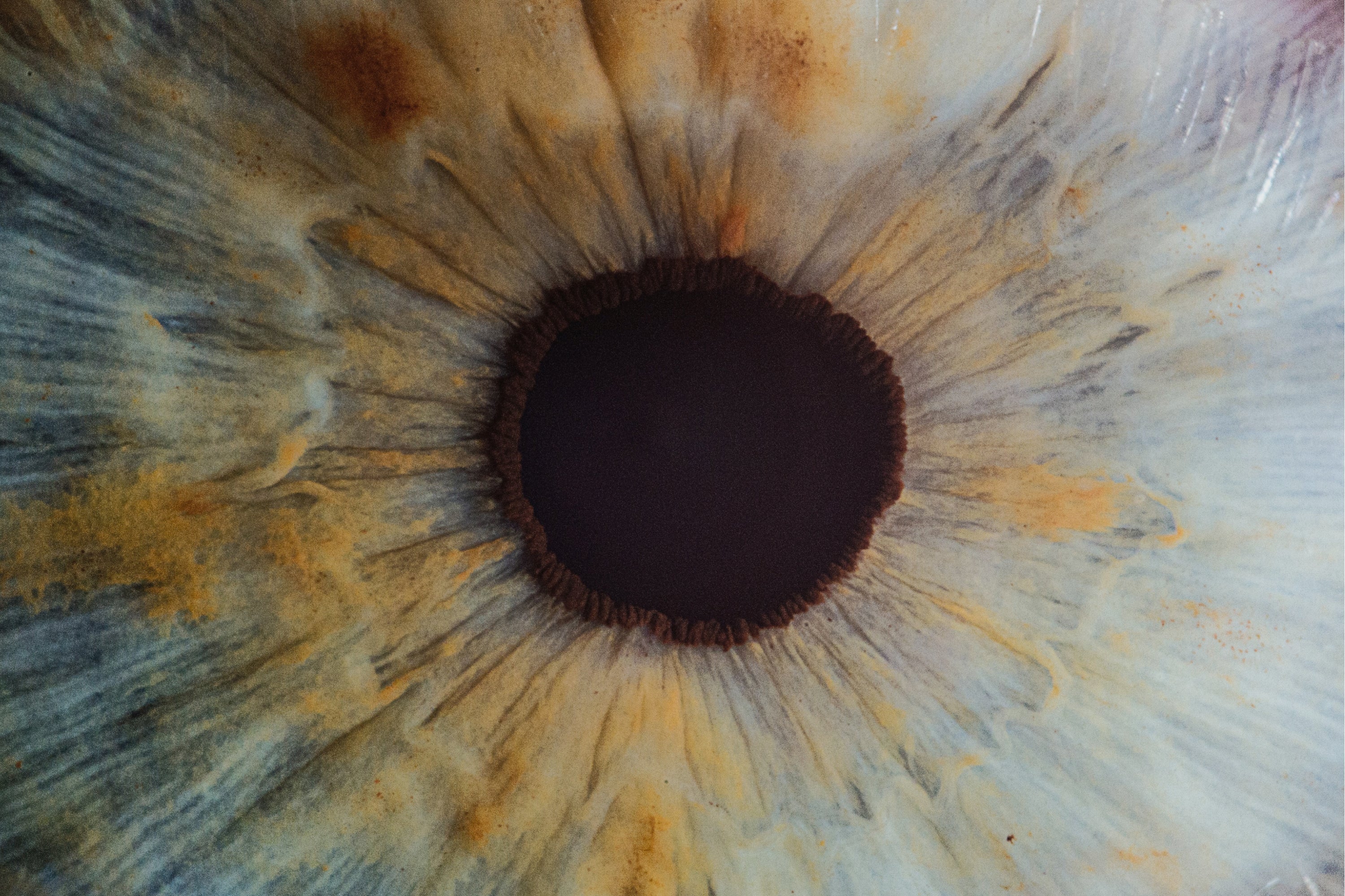 Professor Marcus Fruttiger | Expert Eye Care & MTHK